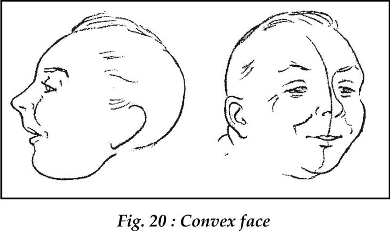 Lateral Curvature of the Face - Sawan Books
